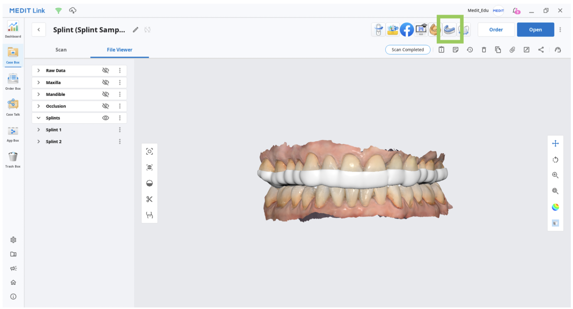Running the Medit Splints app from Medit Link – Medit Help Center