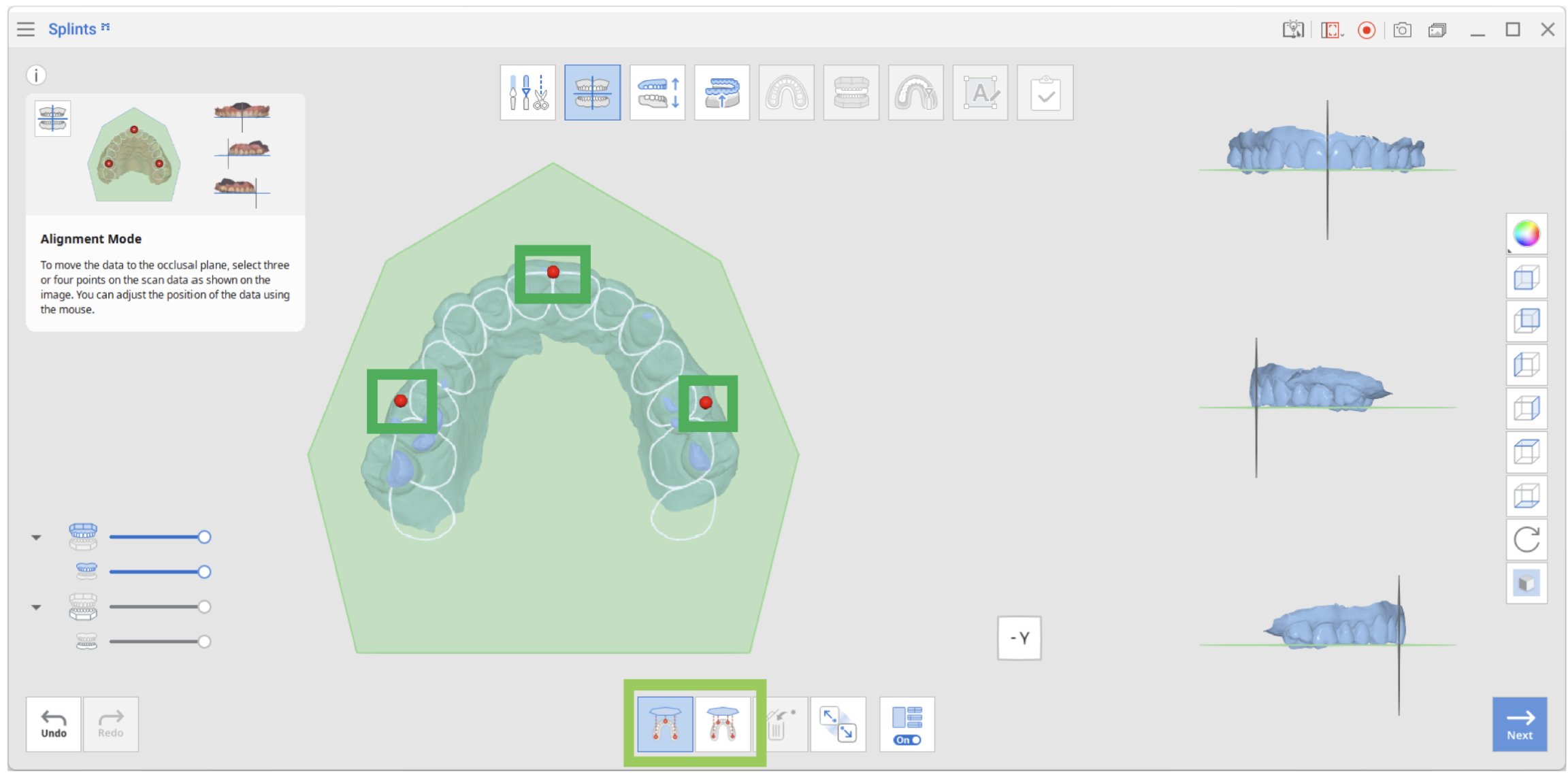 📖 [Splints] Mode > Alignement – Centre d'aide Medit